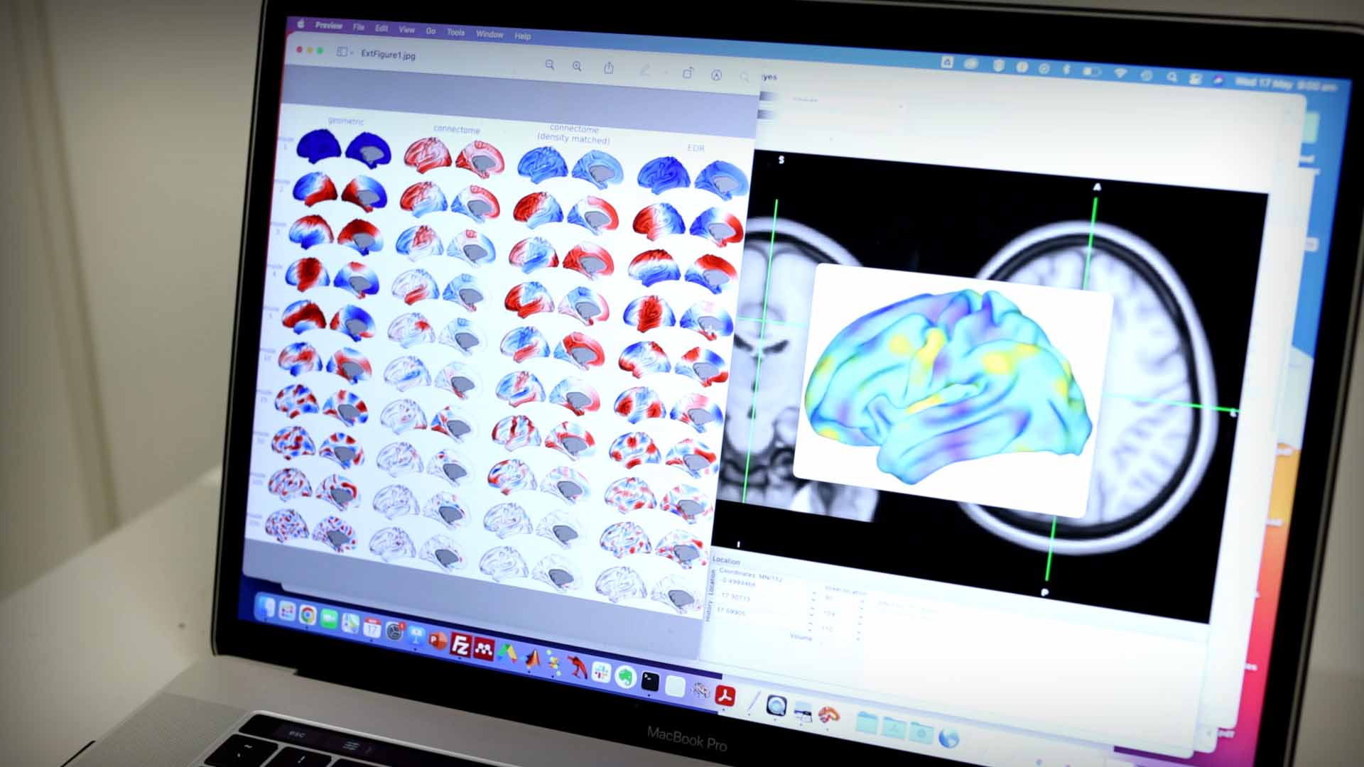 Brain and Mind – Australian Health Journal